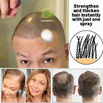 🌿LAST DAY PROMOTION - 70% OFF🌿 HZA™ Natural Hair Regrowth Spray – Tidflare